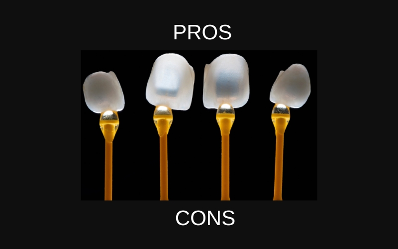 Dental Veneers: Knowing The Pros And Cons
